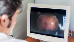 Retinal Diseases: Types, Symptoms and Causes of Retinal Diseases